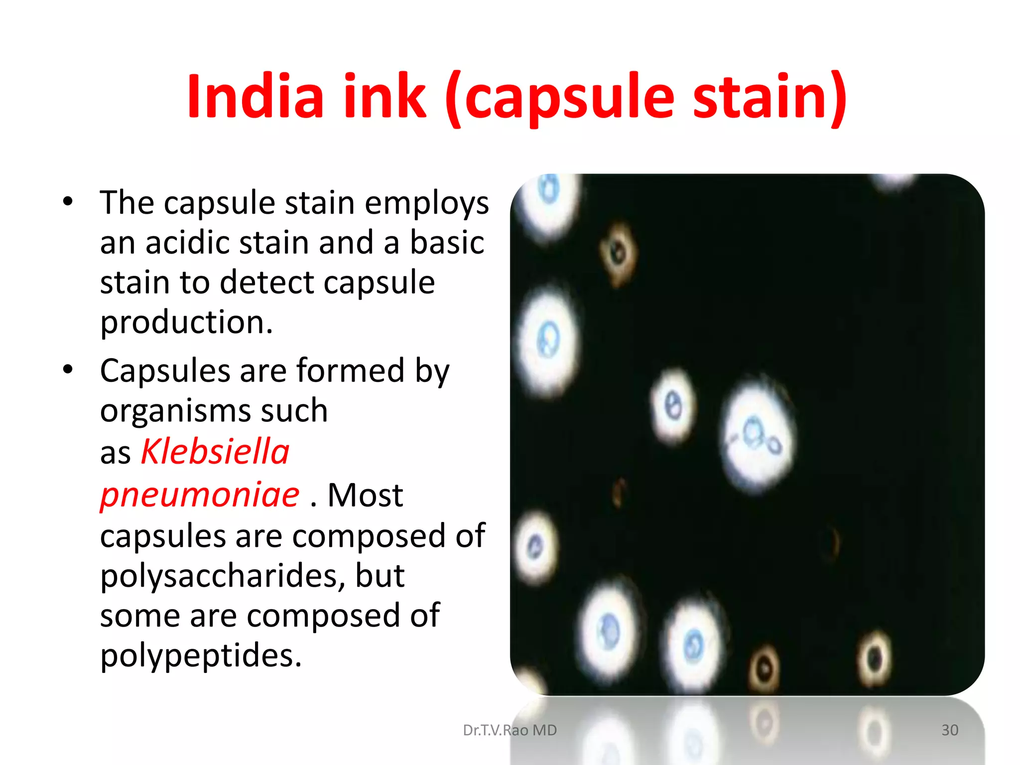 Basics in Identification of Bacteria by Dr.T.V.Rao MD | PPTX