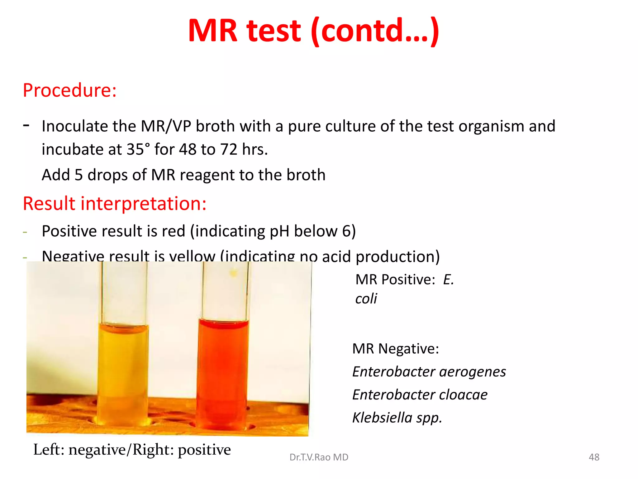 Basics in Identification of Bacteria by Dr.T.V.Rao MD | PPTX
