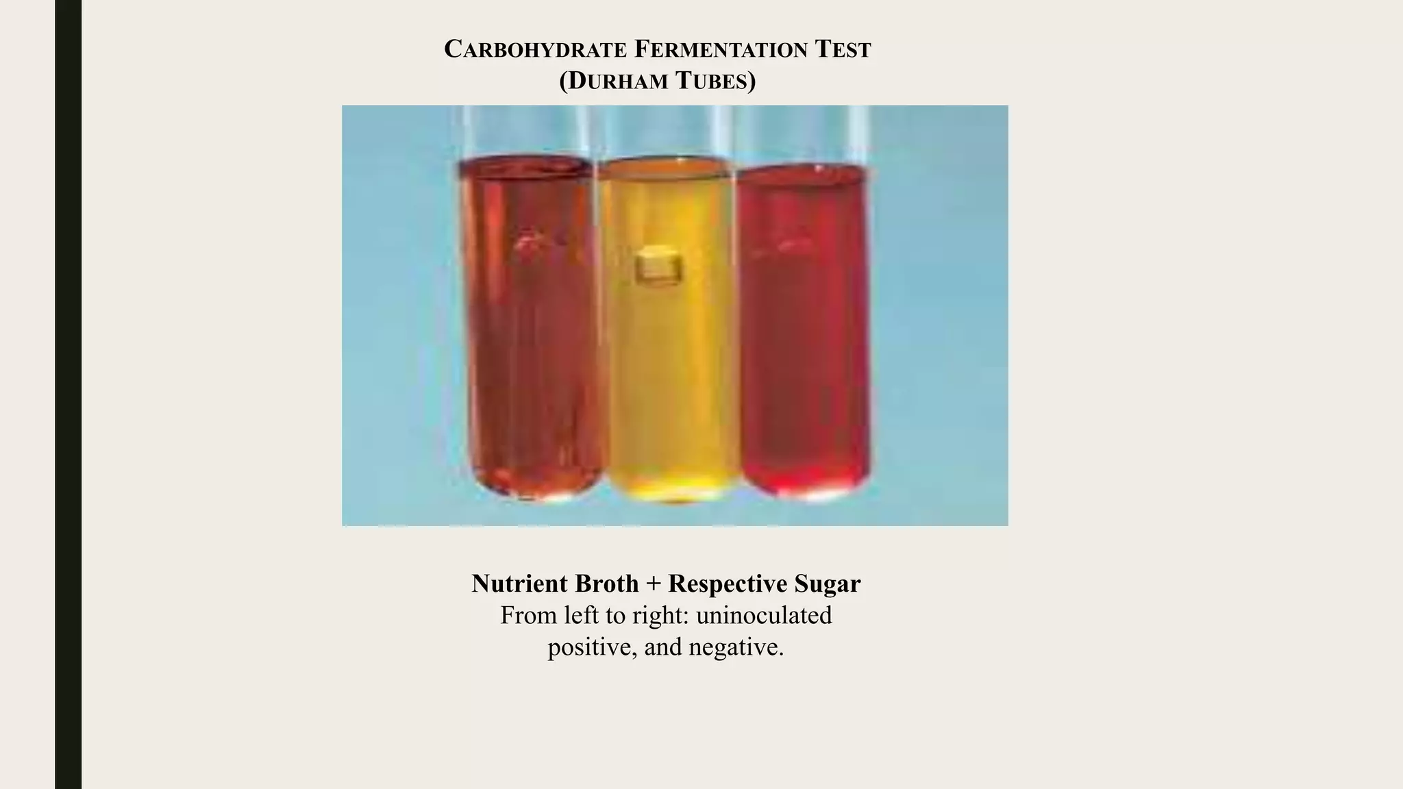 Identification of bacteria by biochemical tests | PPT