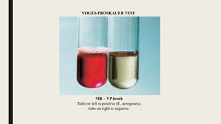 Identification of bacteria by biochemical tests | PPT