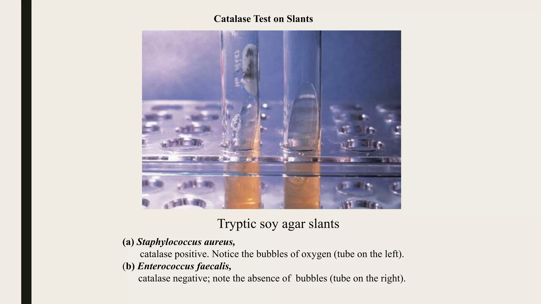 Identification of bacteria by biochemical tests | PPTX