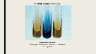 Identification of bacteria by biochemical tests | PPTX