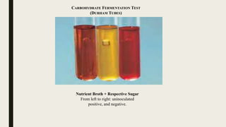 Identification of bacteria by biochemical tests | PPTX