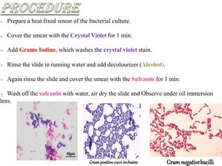 Bacillus Cereus Gram Stain Oil Immersion