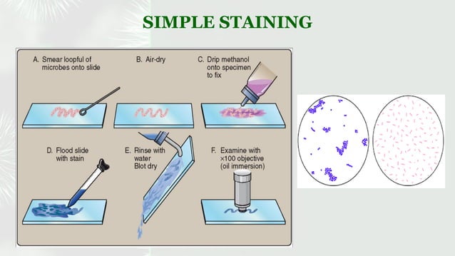Identification of bacteria by staining techniques | PDF | Chemistry ...