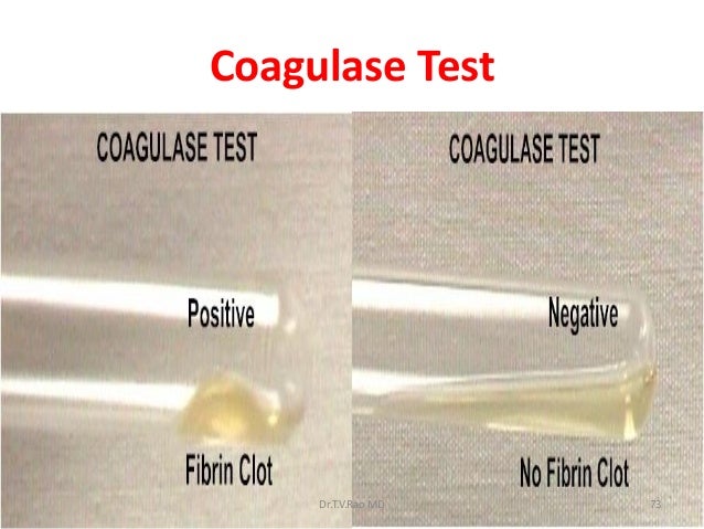 Identificationofbacterialpathogens 111126232752-phpapp01