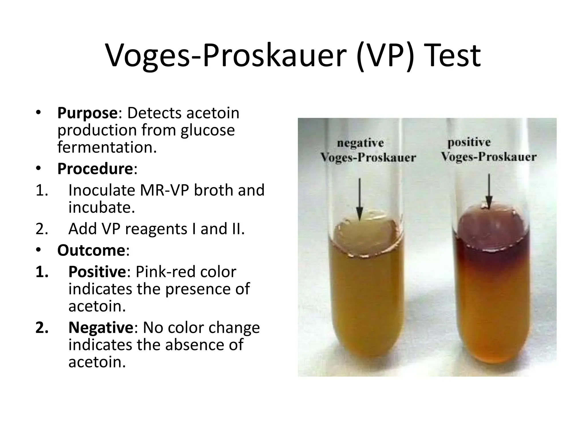 Identification of bacteria using staining techniques | PPTX