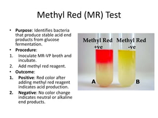 Identification of bacteria using staining techniques | PPTX