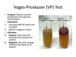 Identification of bacteria using staining techniques | PPTX