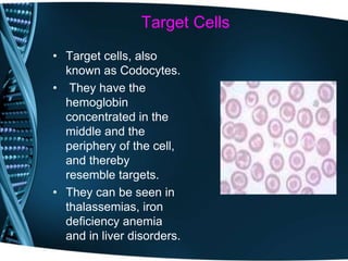 Identification of cells | PPTX | Blood Disorders | Diseases and Conditions