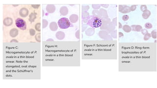 IDENTIFICATION OF COMMON HEMOPARASITES.pptx