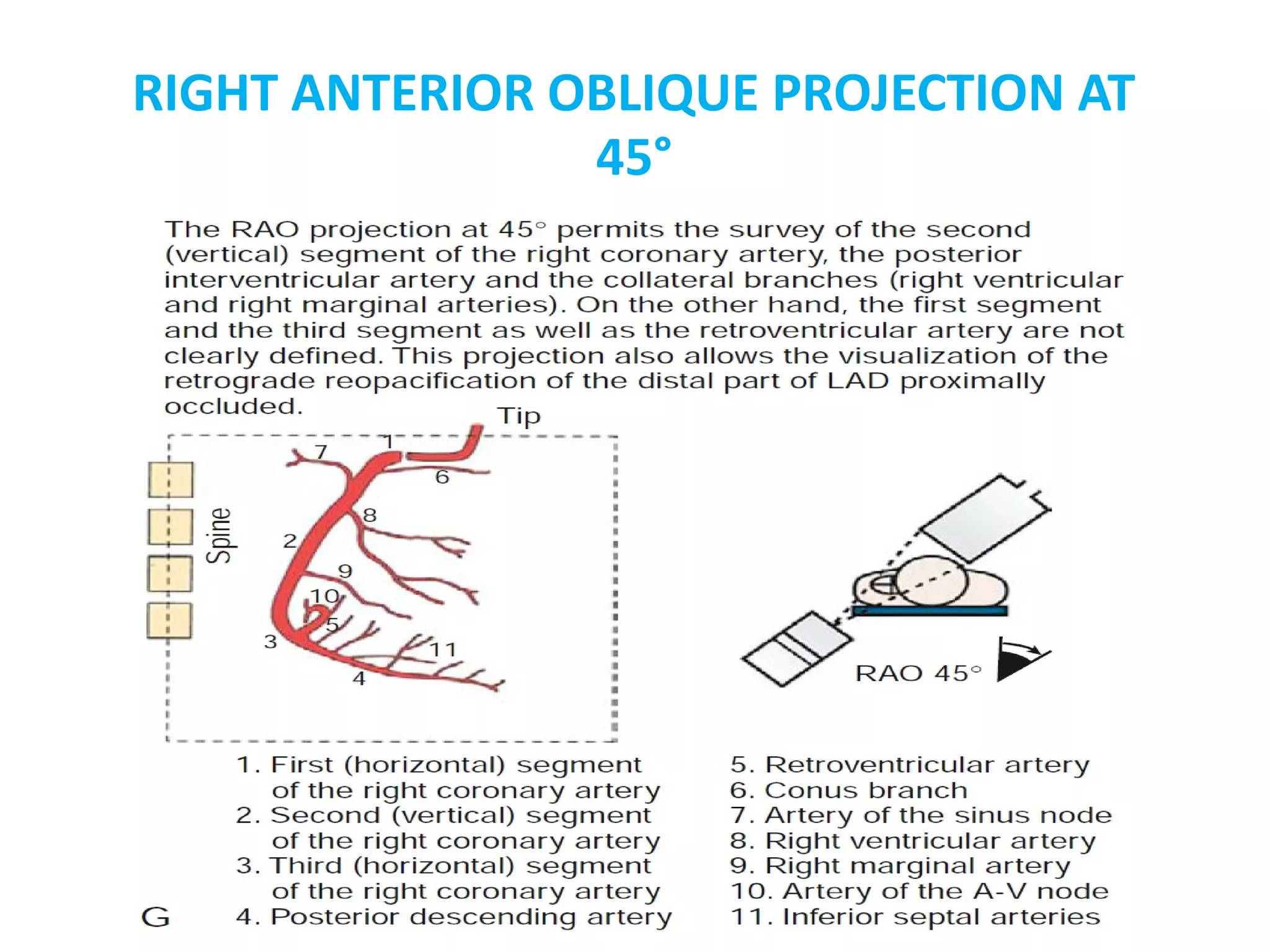 Identification of coronary arteries by different angiographic views ...