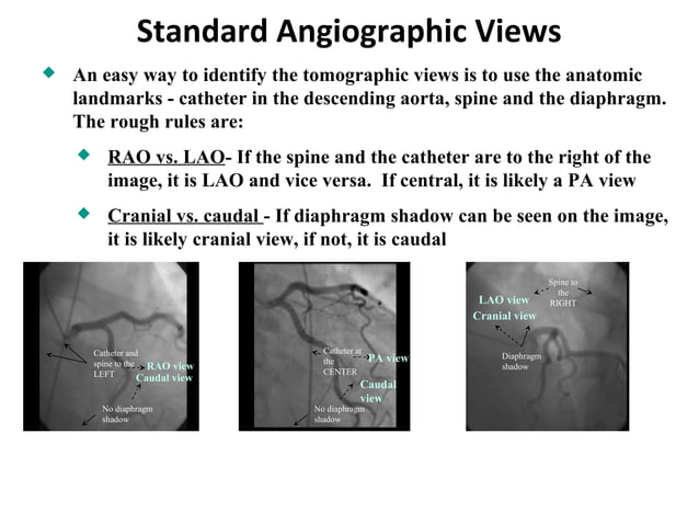 Identification of coronary arteries by different angiographic views ...