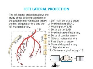 Identification of coronary arteries by different angiographic views ...