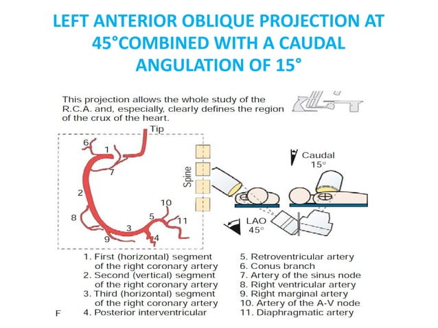 Identification of coronary arteries by different angiographic views ...