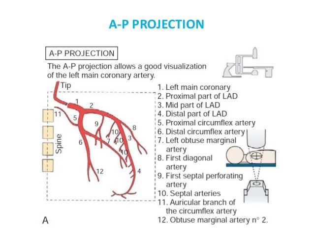 Identification of coronary arteries by different angiographic views