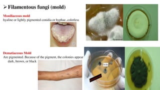 Identification of Fungal Cultures ( Lab.5).pdf