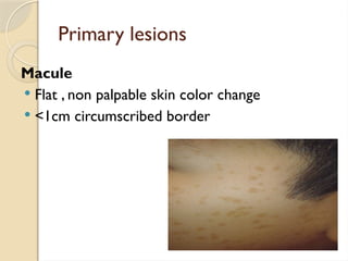 IDENTIFICATION OF LESION 1.pptx for nursing | PPT