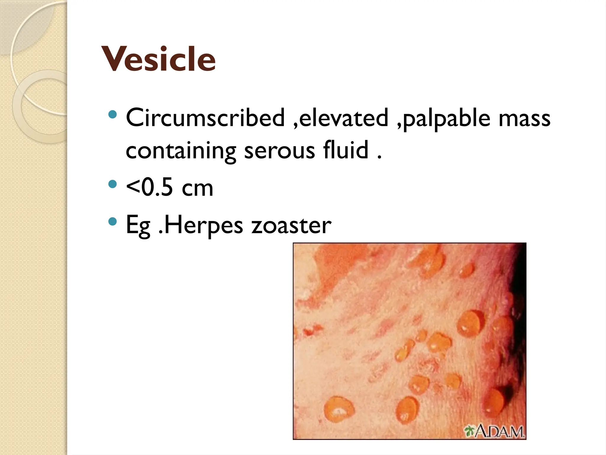 IDENTIFICATION OF LESION 1.pptx foe nursing | PPTX