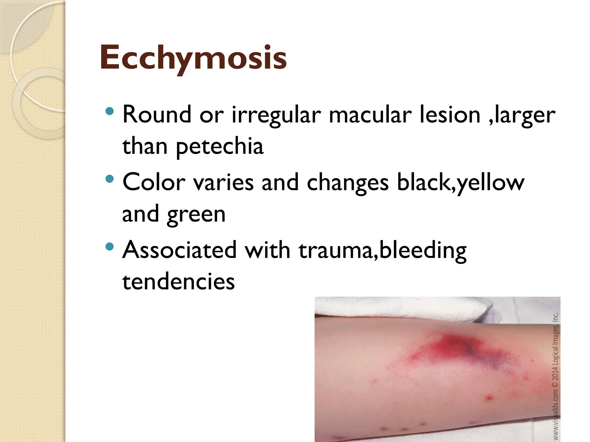 IDENTIFICATION OF LESION 1.pptx foe nursing | PPTX