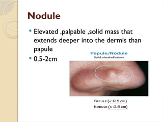 IDENTIFICATION OF LESION 1.pptx foe nursing | PPT