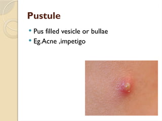 IDENTIFICATION OF LESION 1.pptx foe nursing | PPT
