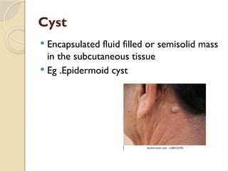 IDENTIFICATION OF LESION 1.pptx foe nursing | PPT