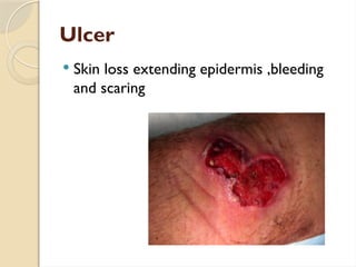 IDENTIFICATION OF LESION 1.pptx foe nursing | PPT