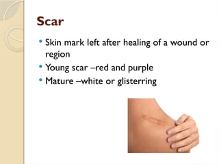 IDENTIFICATION OF LESION 1.pptx foe nursing | PPTX
