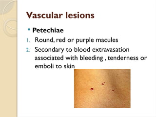 IDENTIFICATION OF LESION 1.pptx foe nursing | PPT