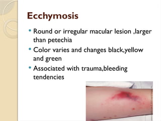 IDENTIFICATION OF LESION 1.pptx foe nursing | PPT