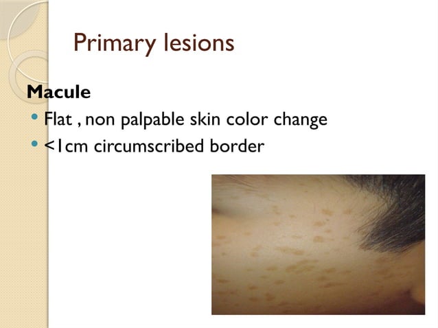 IDENTIFICATION OF LESION 1.pptx foe nursing | PPT
