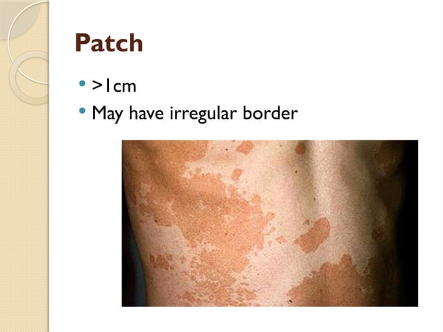 IDENTIFICATION OF LESION 1.pptx foe nursing | PPT
