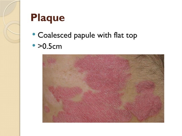 IDENTIFICATION OF LESION 1.pptx foe nursing | PPT