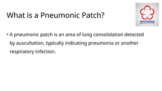 Identification of pneumonic patches.pptx