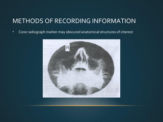 Identification of Radiographs | PPT