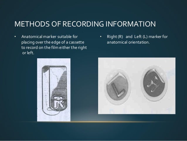Identification of Radiographs