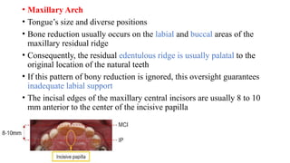 Identification of Shape and Location of Arch Form.pptx