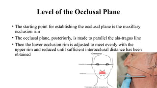 Identification of Shape and Location of Arch Form.pptx