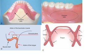 Identification of Shape and Location of Arch Form.pptx