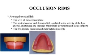 Identification of Shape and Location of Arch Form.pptx