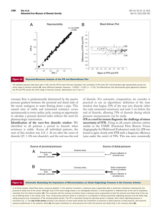 Identification of wave free period in the cardiac cycle | PDF