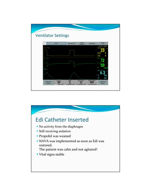 Identifying Asynchrony and Solving the Problem - Pilbeam | PDF