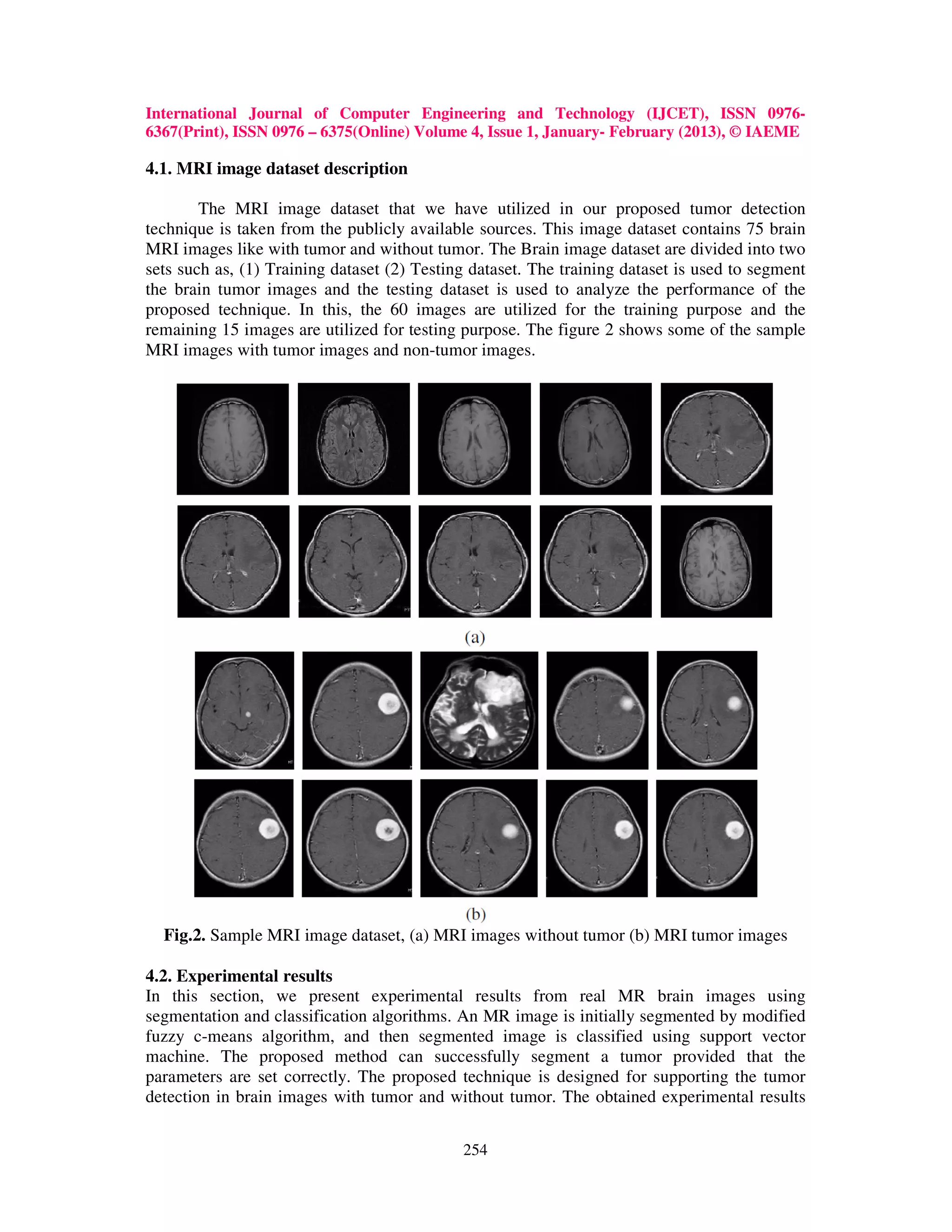 Identifying brain tumour from mri image using modified fcm and support ...