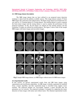 Identifying brain tumour from mri image using modified fcm and support ...