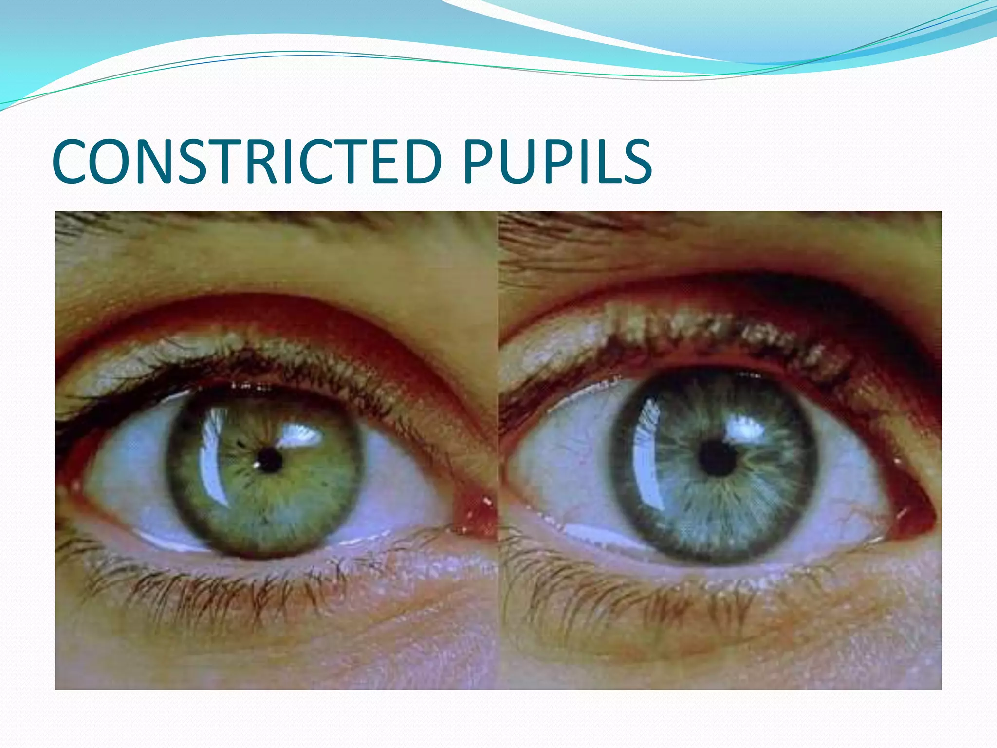 Identifying signs of drug abuse | PDF