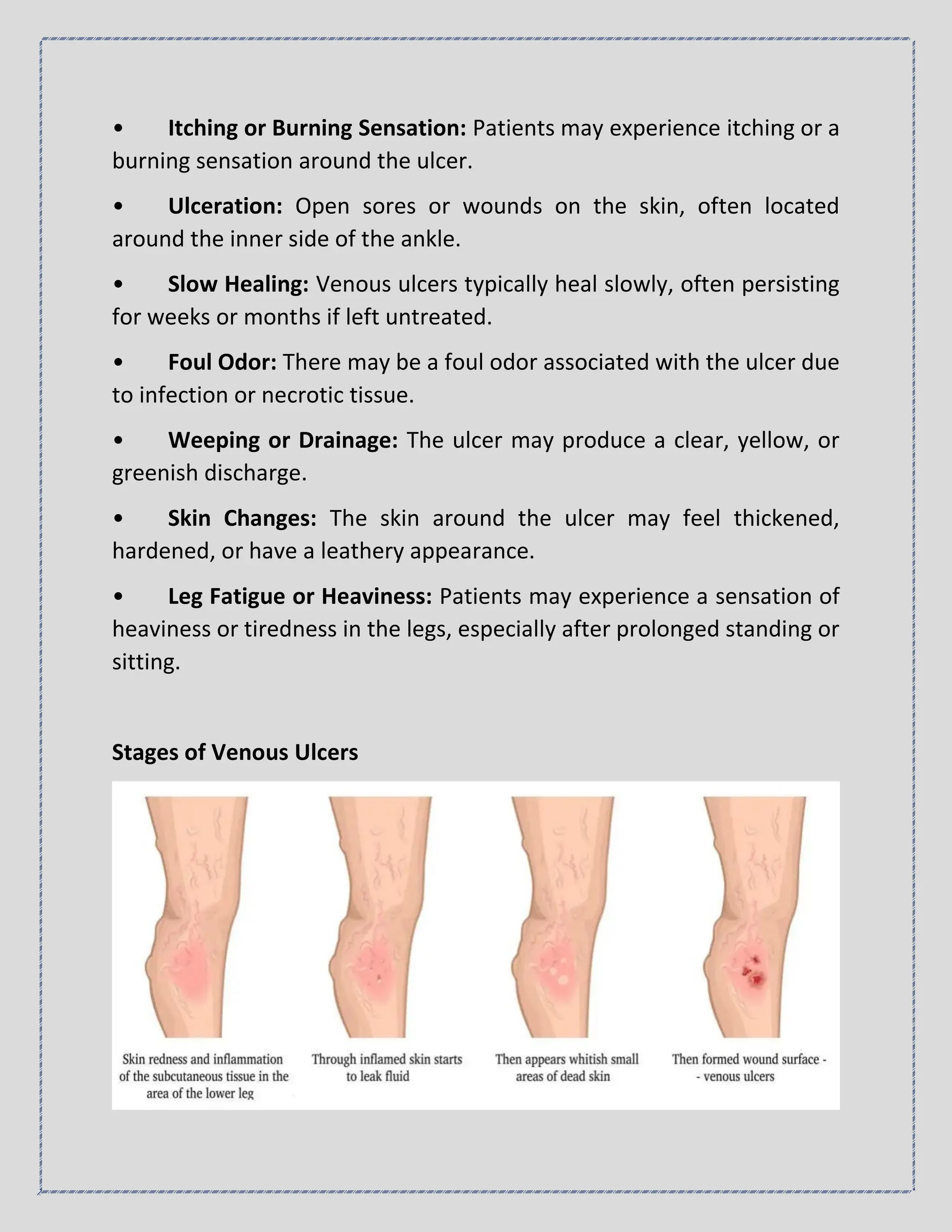 Identifying Symptoms, Causes, and Exploring Treatment Options of Venous ...