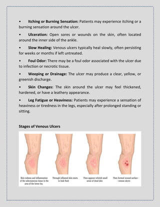 Identifying Symptoms, Causes, and Exploring Treatment Options of Venous ...