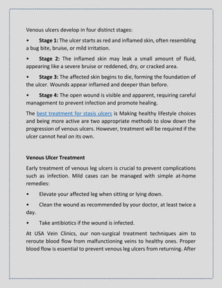 Identifying Symptoms, Causes, and Exploring Treatment Options of Venous ...