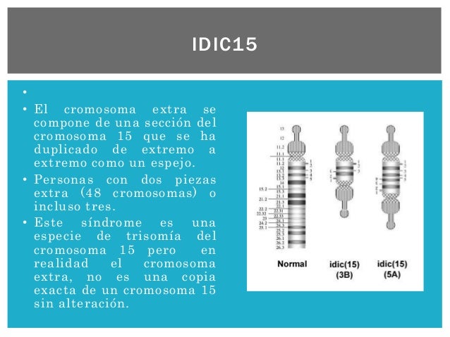 Idic15